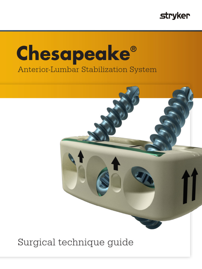 Chesapeake ALIF Surgical Technique - OUS Version | PDF | Drill | Screw