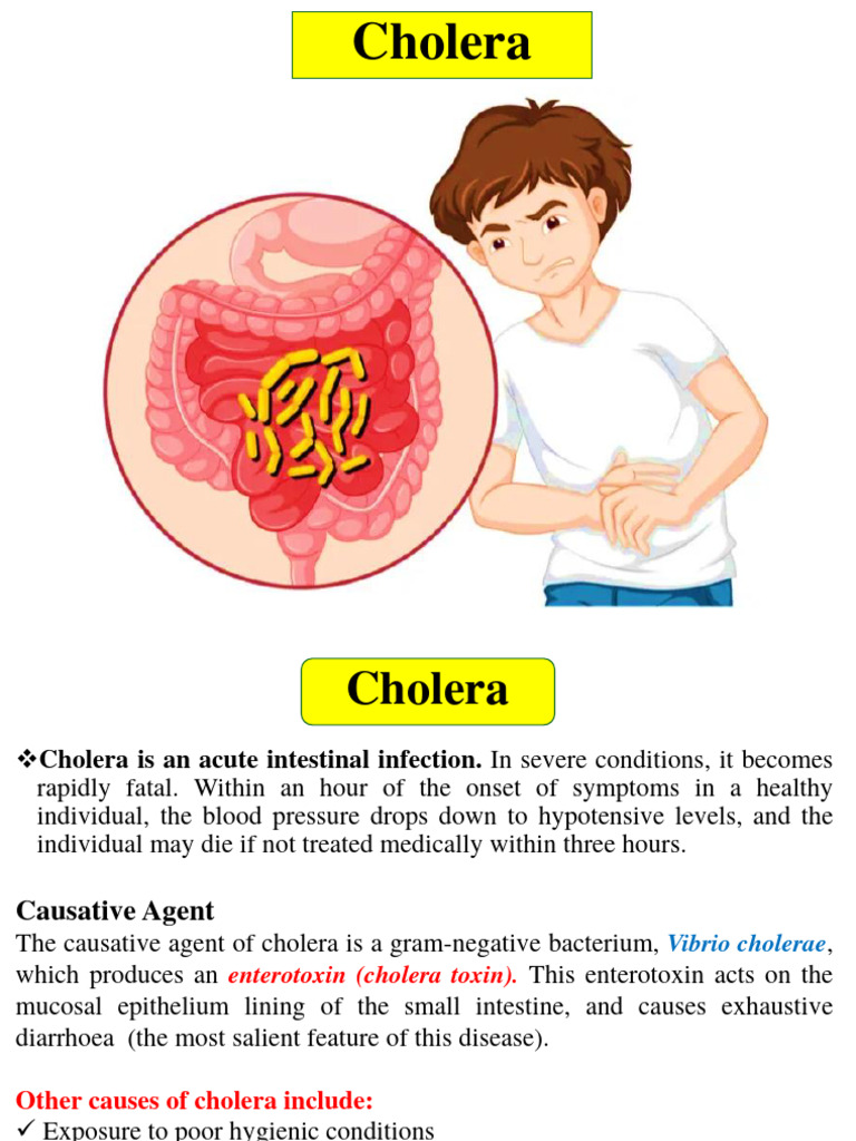 Cholera | PDF | Cholera | Diarrhea