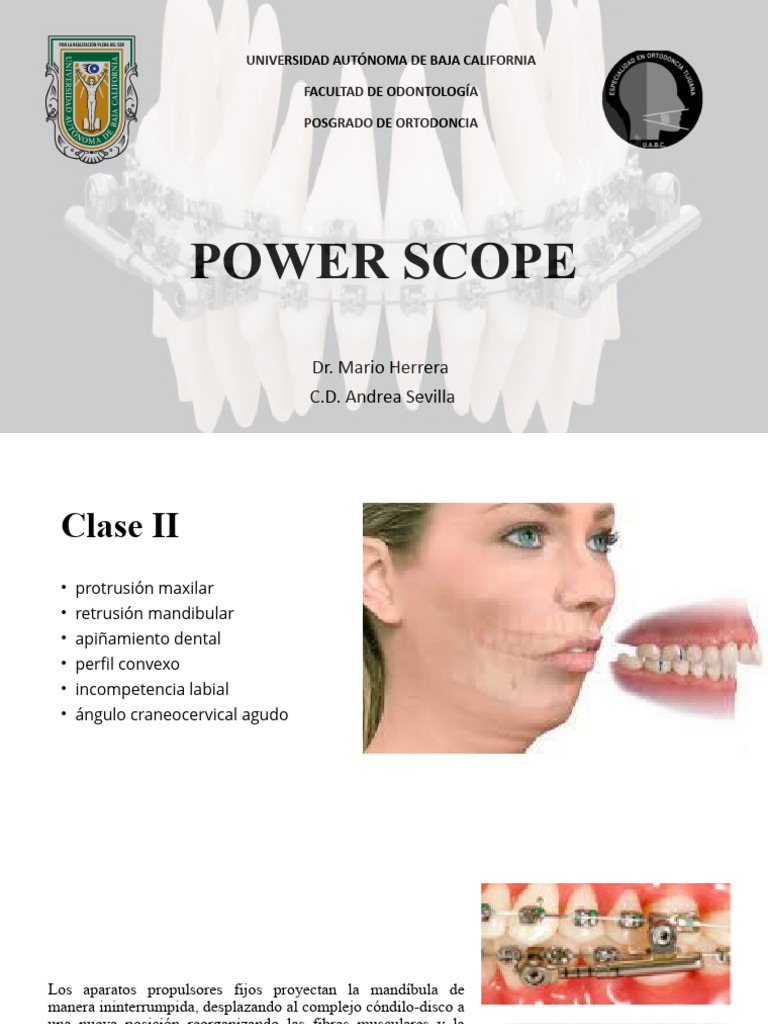 Power Scope | PDF | Ramas de Odontología | Diente