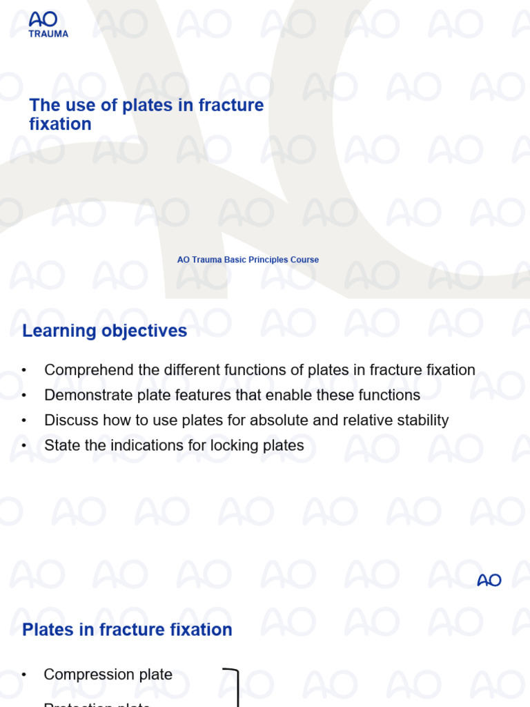 2.3 Use of Plates in Fracture Fixation | PDF | Tension (Physics) | Bone