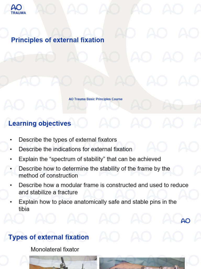 2.4 Principles of External Fixation | Download Free PDF | Surgical ...