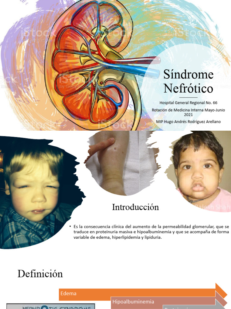 SINDROME NEFROTICO | PDF | Enfermedades y trastornos | Medicina CLINICA