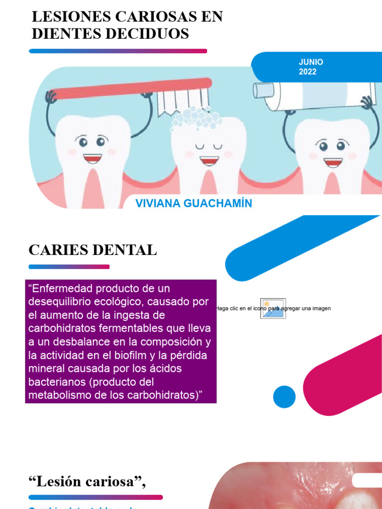 Lesiones Cariosas en Dientes Deciduos | PDF | Diente | Calcio
