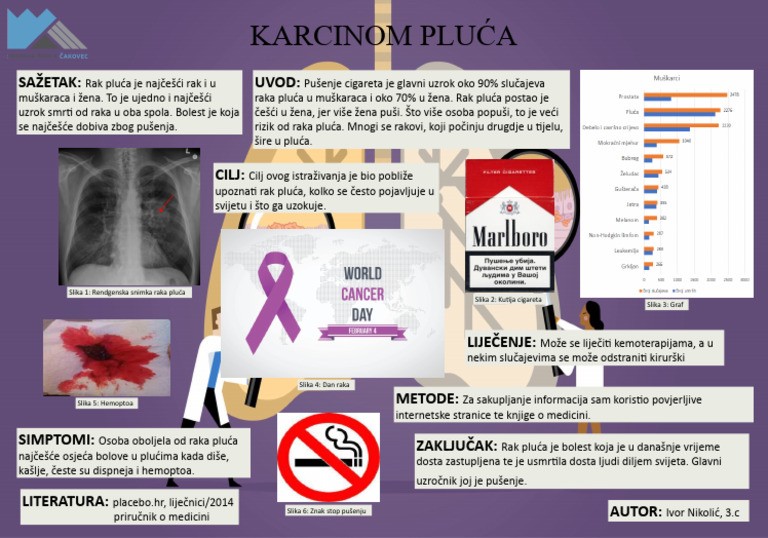 Karcinom Pluća | PDF