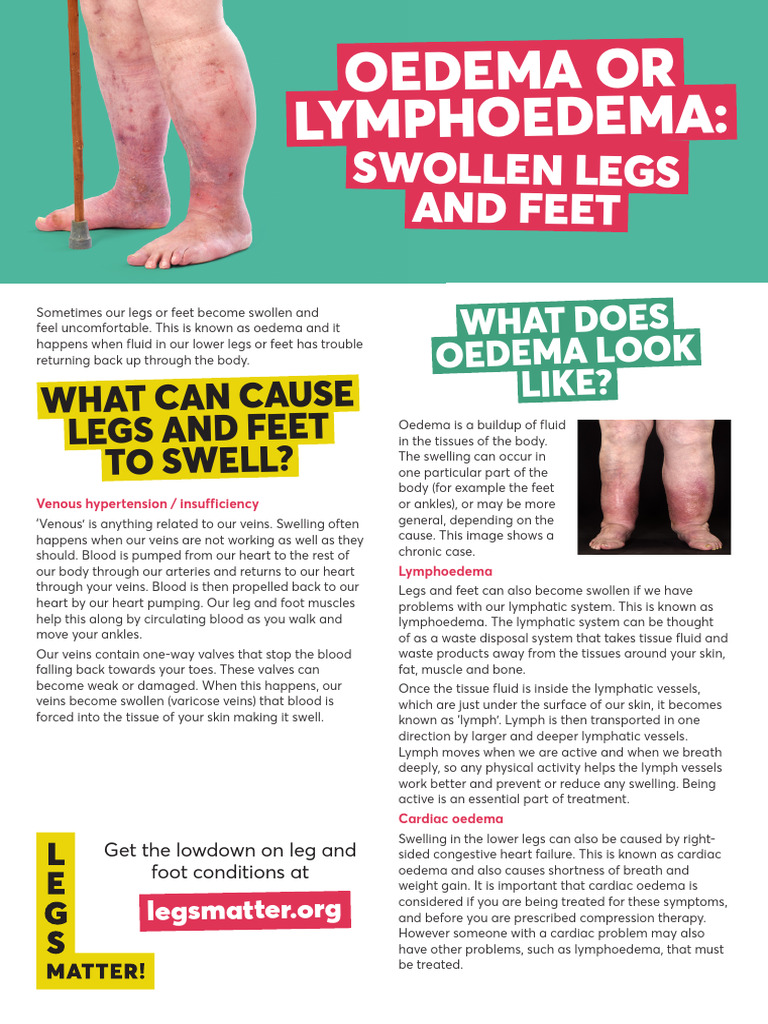 LEGS-MATTER-PATIENTS-SWOLLEN-LEGS-FEET-A4 | PDF | Edema | Vein