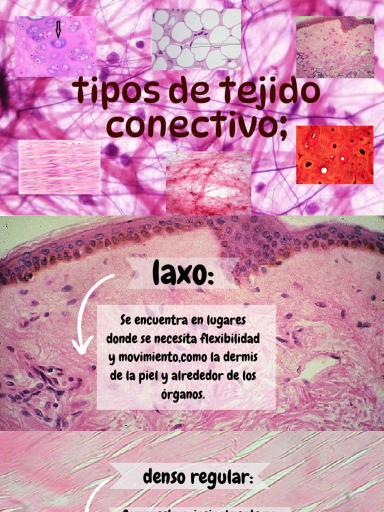 Tipos de Tejidos Conectivos | PDF