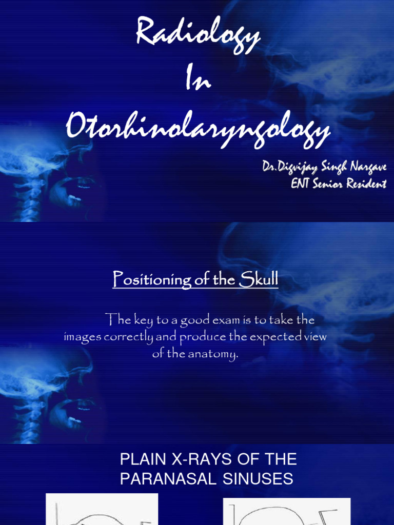 Radiology in ENT-1 | PDF | Human Nose | Radiography