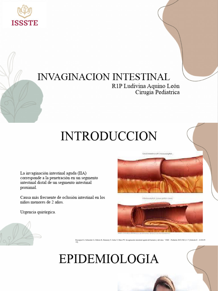 Invaginacion Intestinal | PDF | Tracto gastrointestinal ...