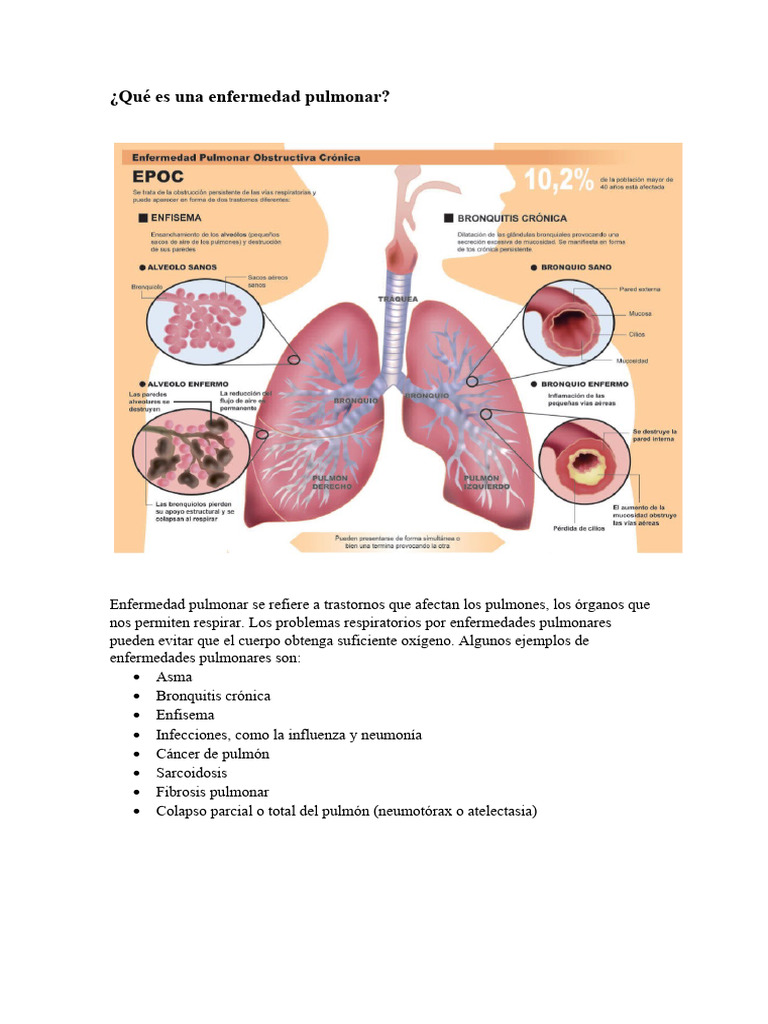 enfermedades pulmonares | PDF | Pulmón | Enfermedades y trastornos humanos