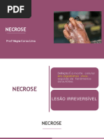 Tipos de Necrose e Suas Características | PDF | Necrose | Biologia
