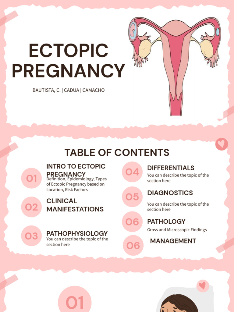 Ectopic Pregnancy - Ob Patho | PDF | Human Chorionic Gonadotropin | Mammal Female Reproductive ...