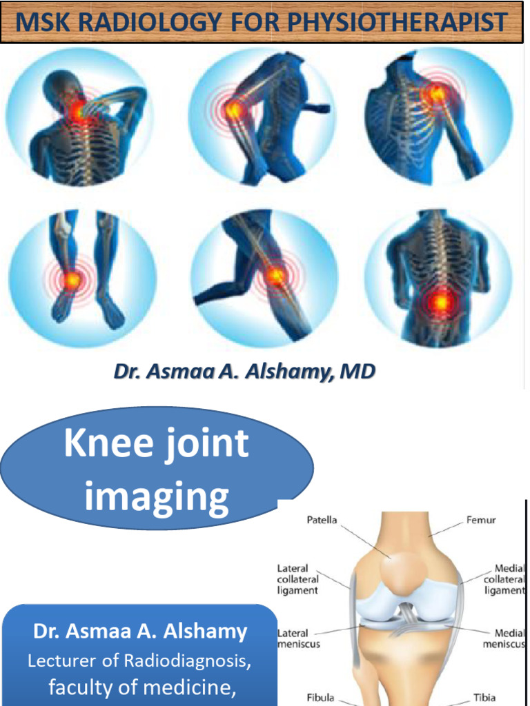 5-Knee joint | PDF | Knee | Injury