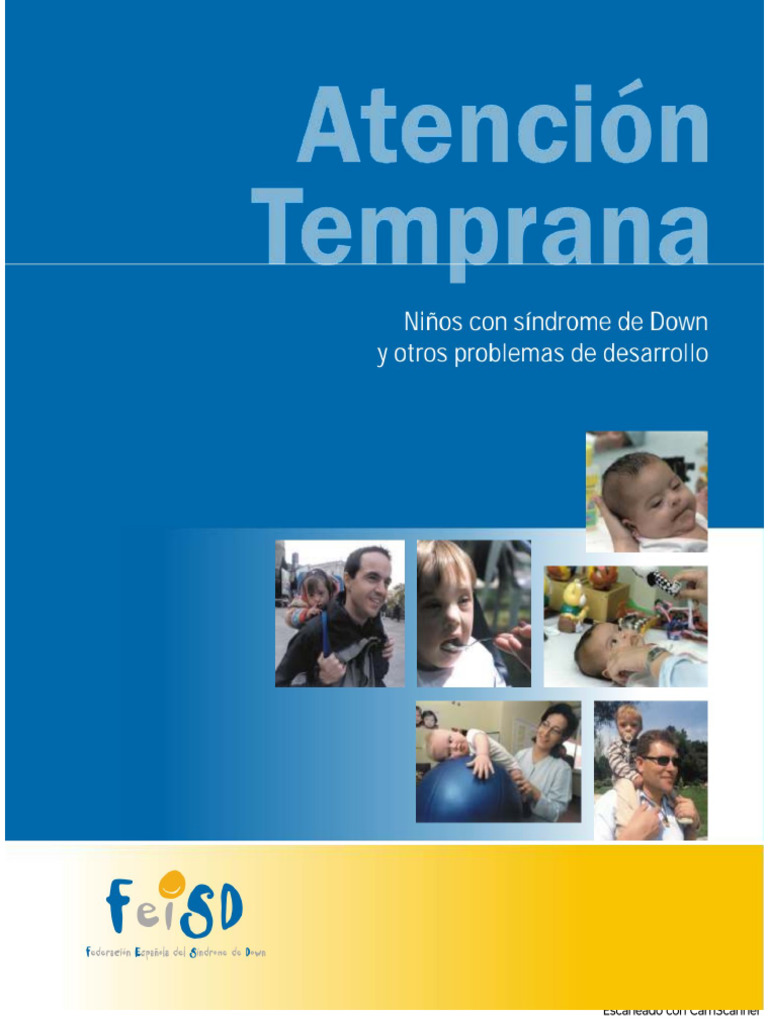 6 0 Atencion Temprana Sindr Down | PDF