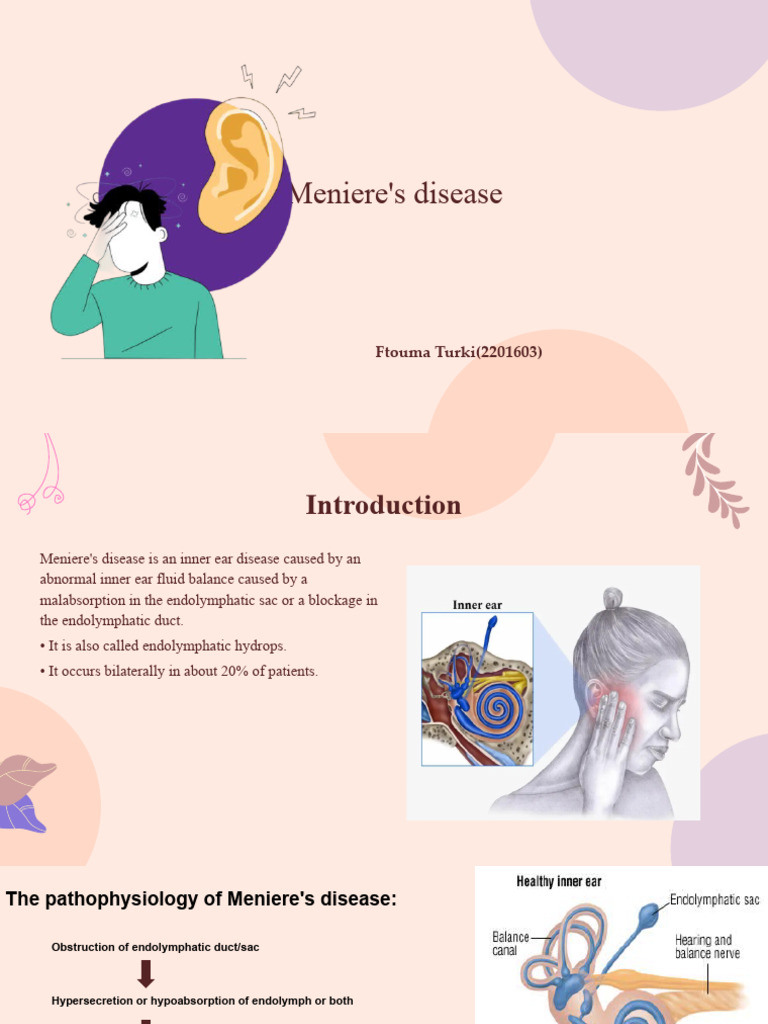 Meniere Disease | PDF