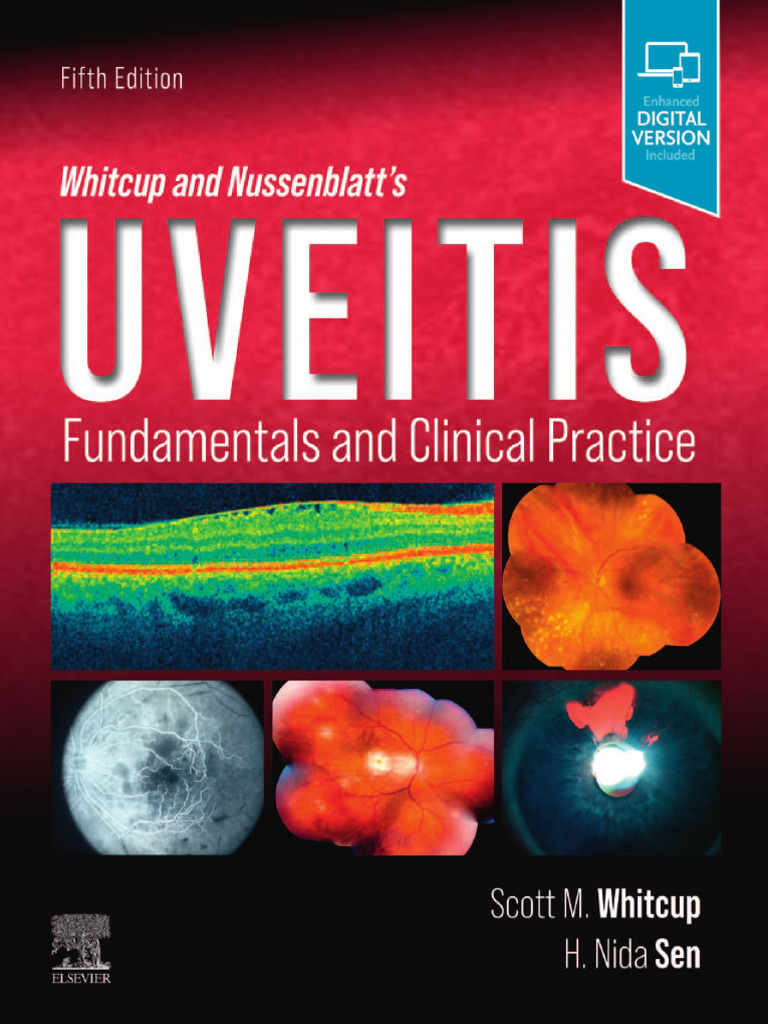 Uveitis Fundamentals and Clinical Practice | PDF | Immune System | T Cell