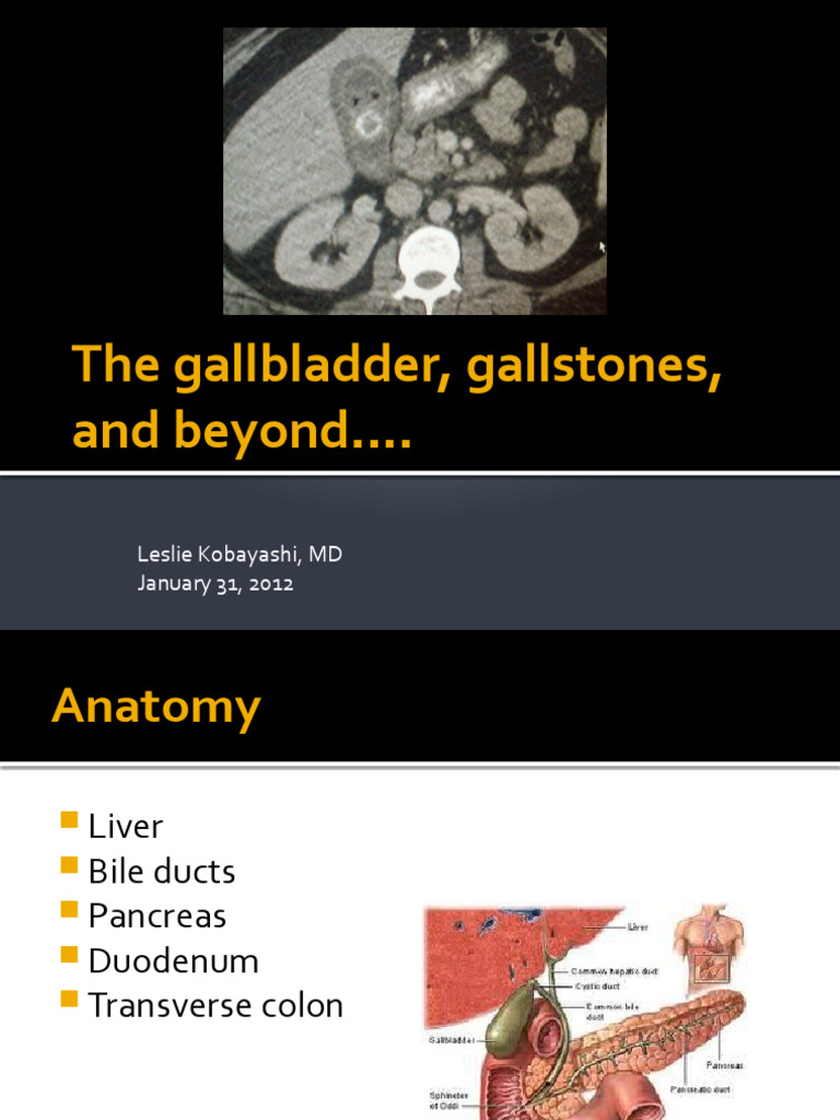 Gallbladder Gallstones Beyond | PDF | Liver | Gallbladder