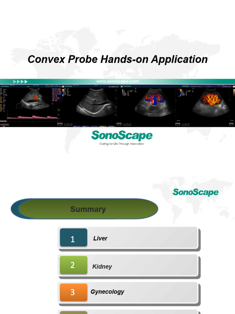 Convex Probe Hands-On Application | PDF | Liver | Vein