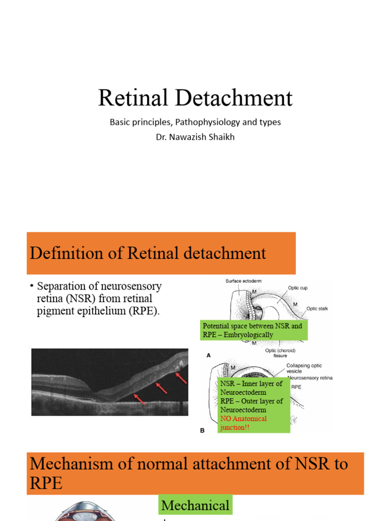 Retinal Detachment: Basic Principles, Pathophysiology and Types Dr ...