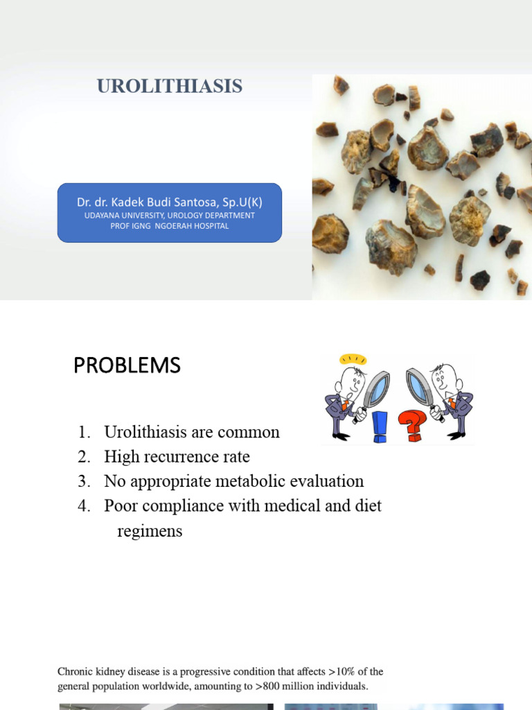 Lecture 9. UROLITHIASIS BLOK 2023-compressed | PDF | Urology | Medical Specialties