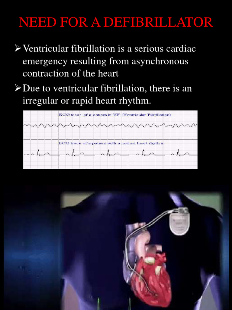 Defibrillator | PDF | Cardiac Electrophysiology | Cardiovascular System