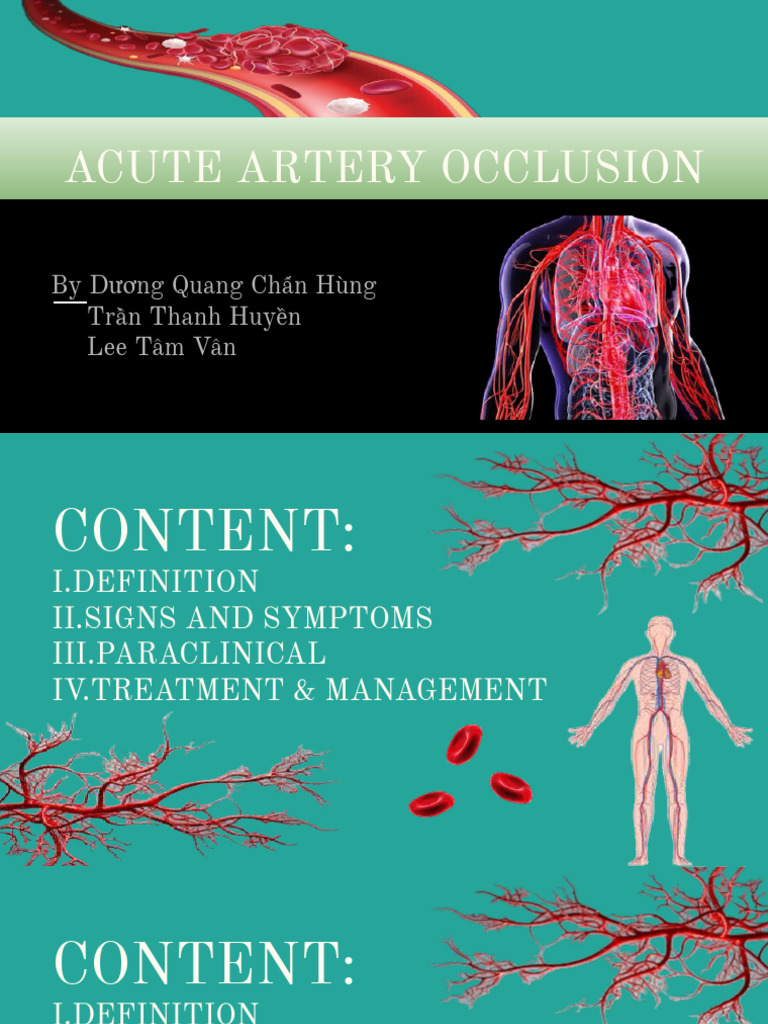 ACUTE ARTERIAL OCCLUSION | PDF