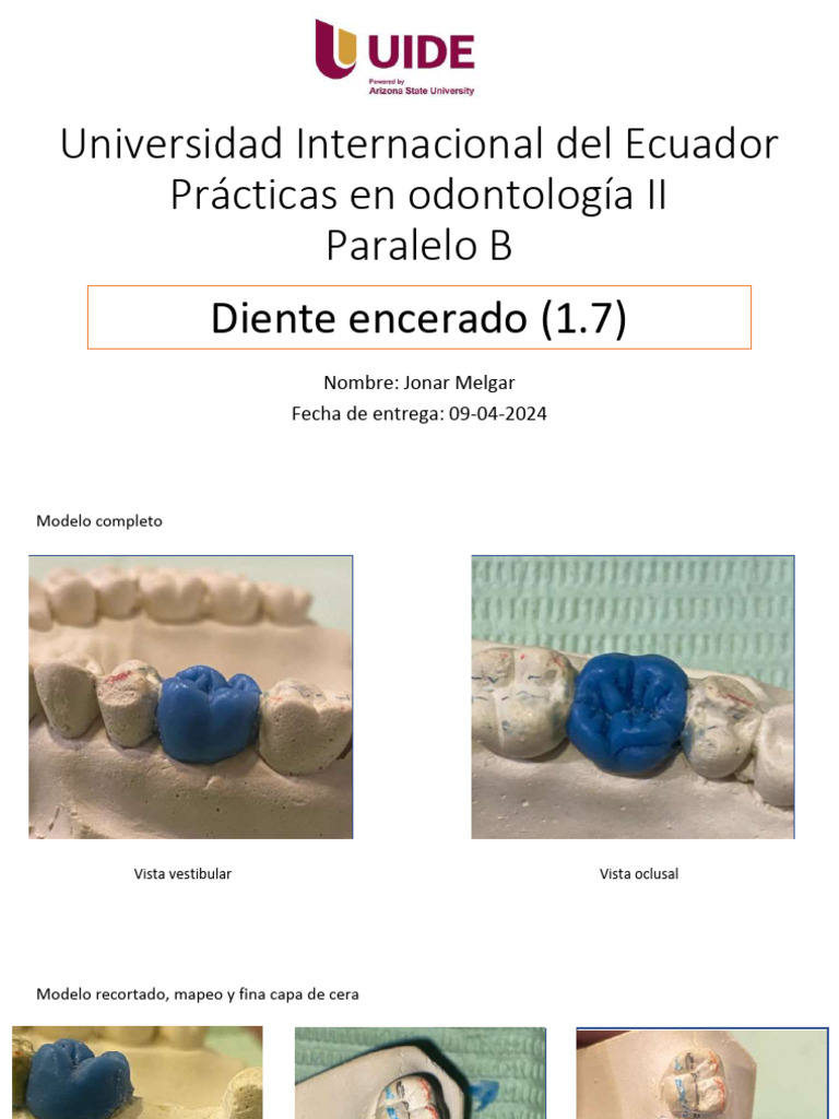 Informe Encerado Segundo Molar - MelgarJonar | PDF | Diente | Anatomia dental