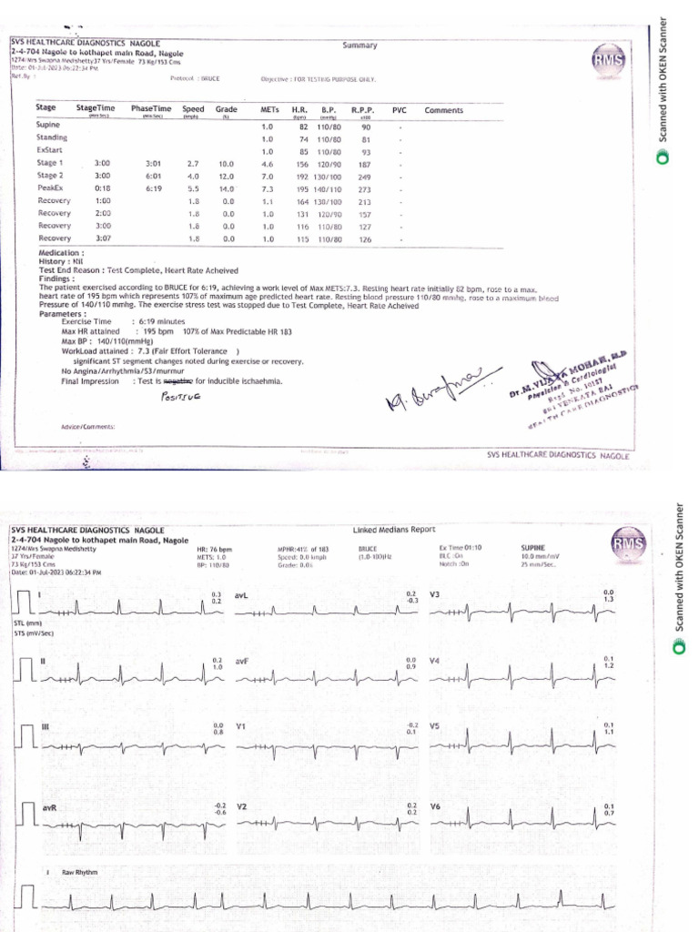 Ecg TMT-3 | PDF
