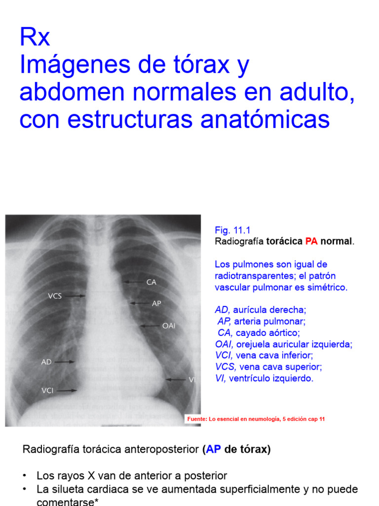 RX Normal de Tórax PA y AP, y Abdomen, Estructuras Anatómicas | PDF ...