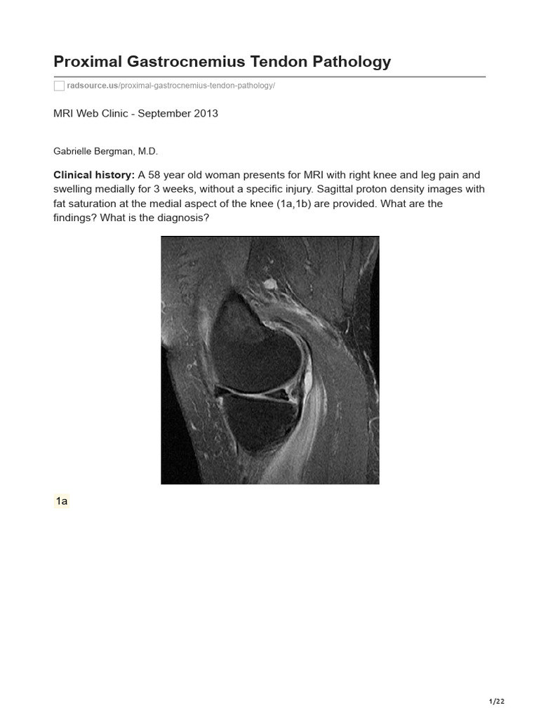 Proximal Gastrocnemius Tendon Pathology | PDF | Knee | Human Leg