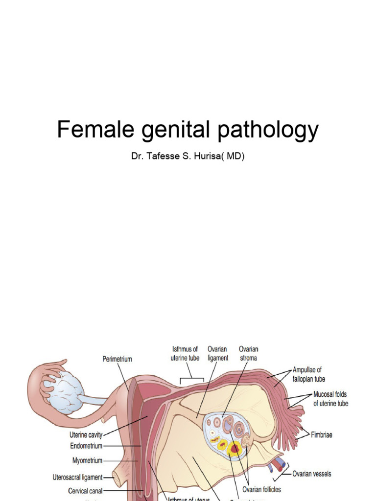 Female Genital Pathology | PDF | Ovarian Cancer | Carcinoma
