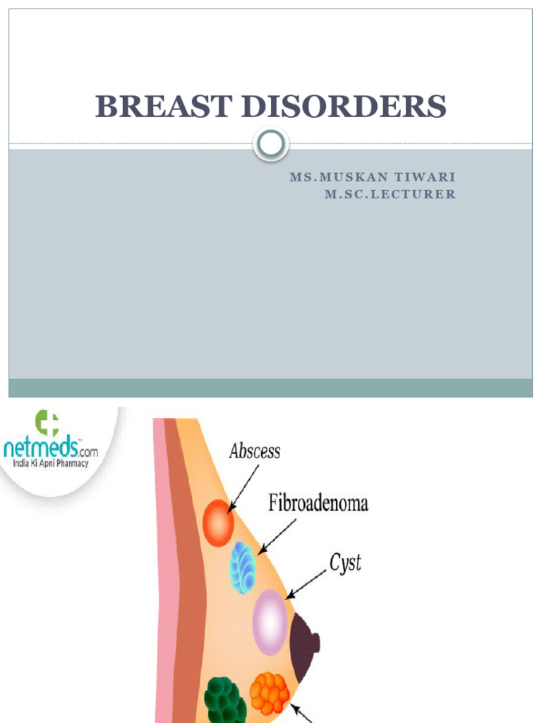 Breast Disorders | PDF | Breast Cancer | Mastectomy