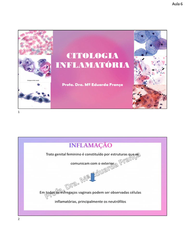 Aula 6 - Citologia Inflamat Ria Profa M Eduarda 2023 | PDF | Inflamação ...