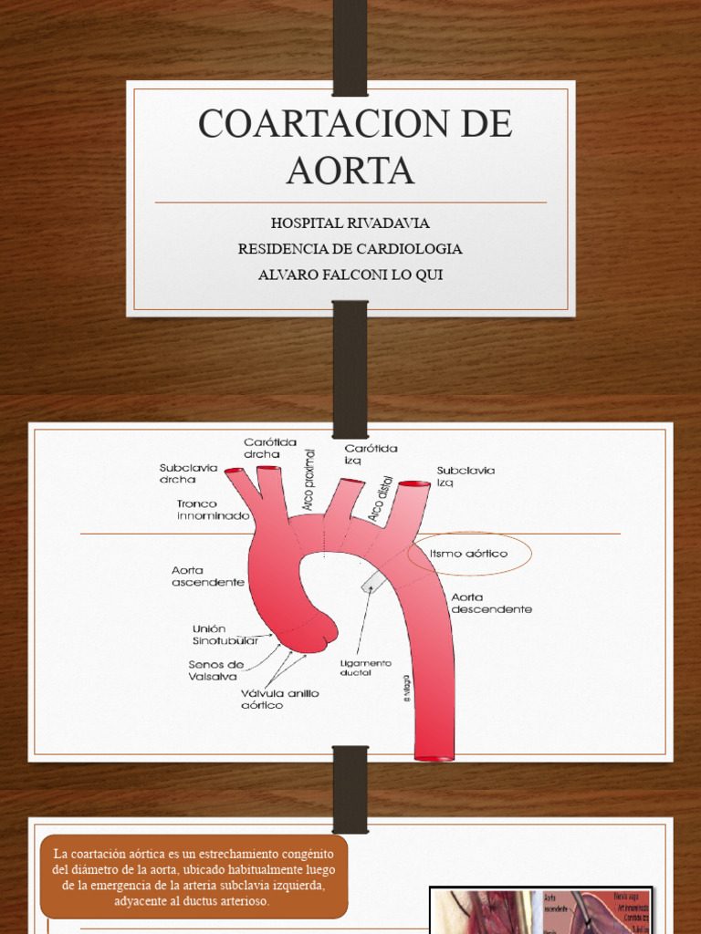 COARTACION DE AORTA | PDF | Aorta | Sistema cardiovascular