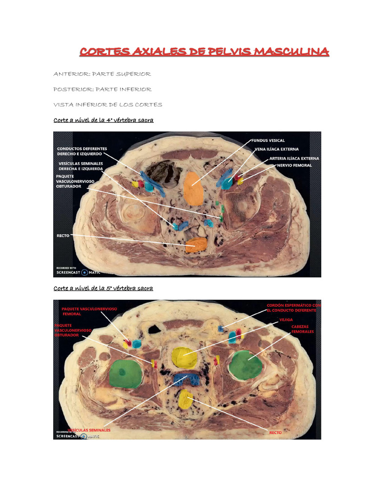 Cortes Axiales de Pelvis Humana | PDF