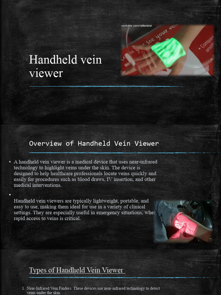 Handheld Vein Viewer. | PDF | Infrared | Mobile Device