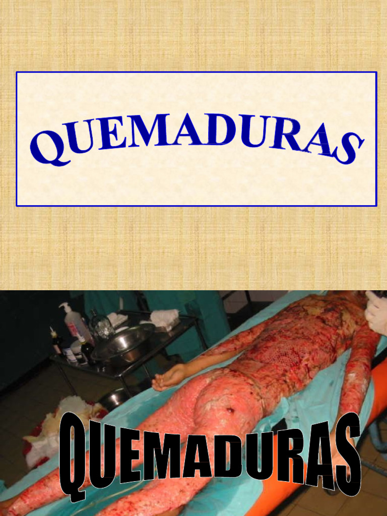 Manejo de Quemados | PDF | Quemar | Especialidades Medicas