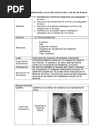 Cómo leer una radiografía de tórax | PDF | Tórax | Tórax (anatomía humana)