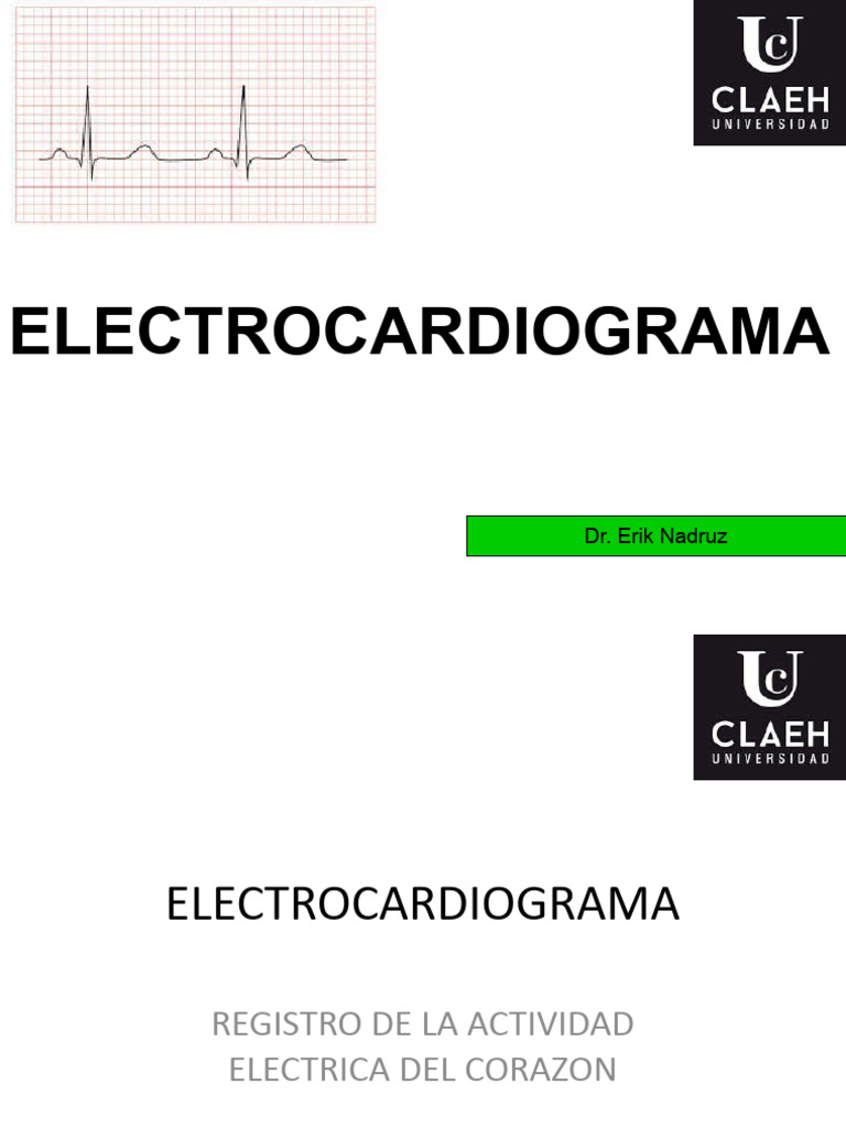 Electrocardiograma 2024: Guía Completa | PDF | Ciencia y matemáticas