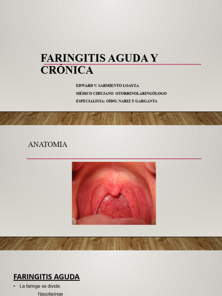 Faringitis Aguda y Crónica 1 | PDF | Alergia | Especialidades Medicas