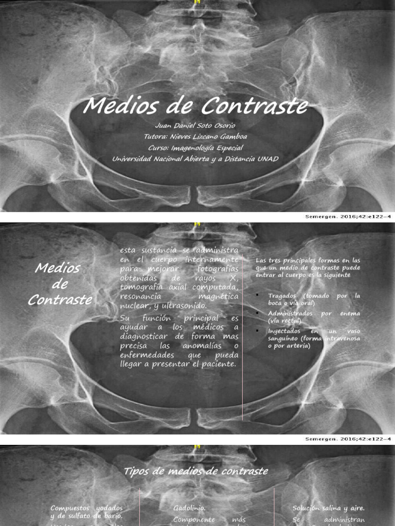 Tema 1 Medios de contraste. | PDF | Imagen de resonancia magnética ...