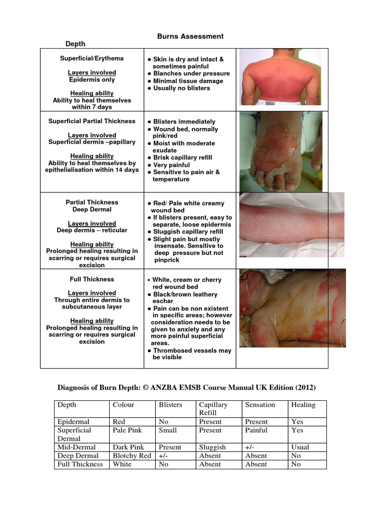 Burns Assessment | PDF | Skin | Integumentary System