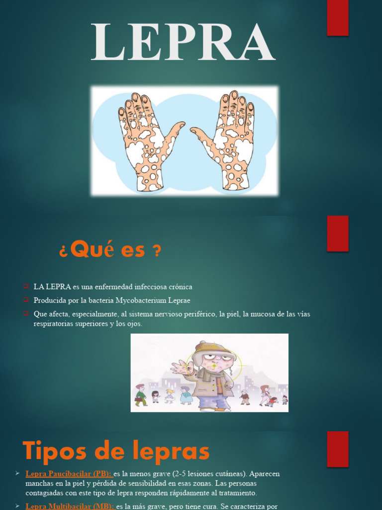 Todo sobre la lepra: causas, tipos y tratamiento | PDF | Lepra ...