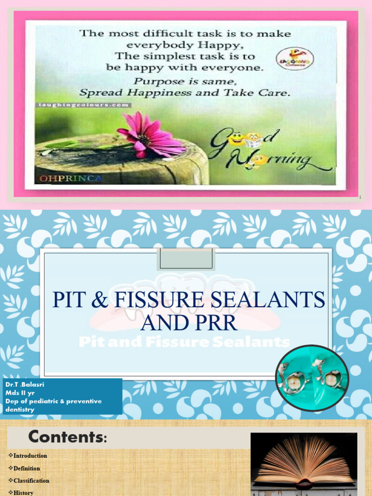 Pit and Fissure Sealents and PRR | PDF | Dental Composite | Dentistry