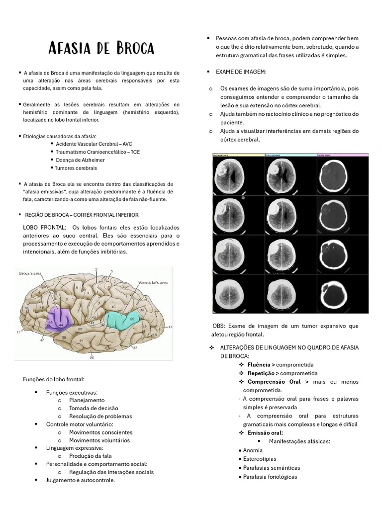 Afasia de Broca | PDF | Afasia | Neurociência