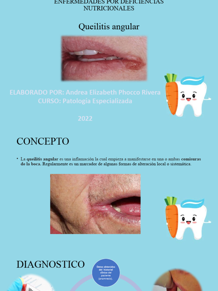 Queilitis Angular | Descargar gratis PDF | Vitamina a | Vitamina