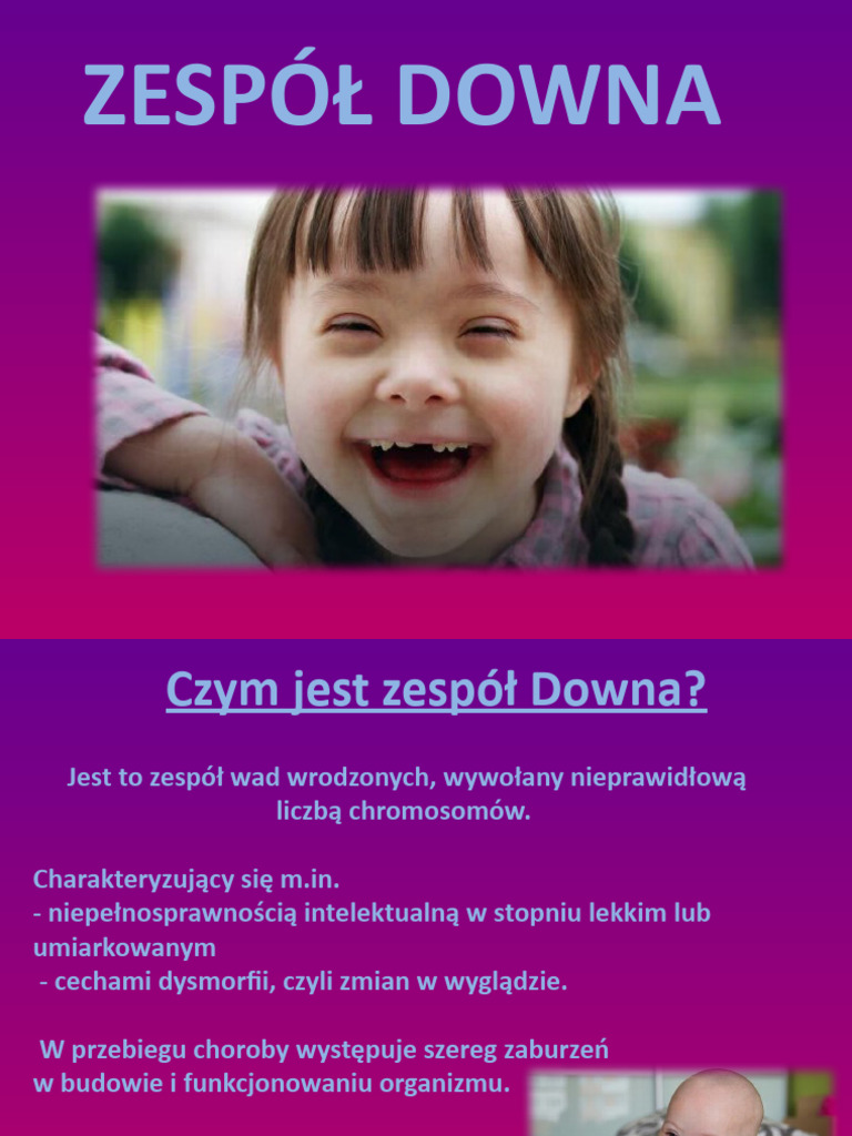 Prezentacja-zespol-Downa_(1)_poprawione | PDF