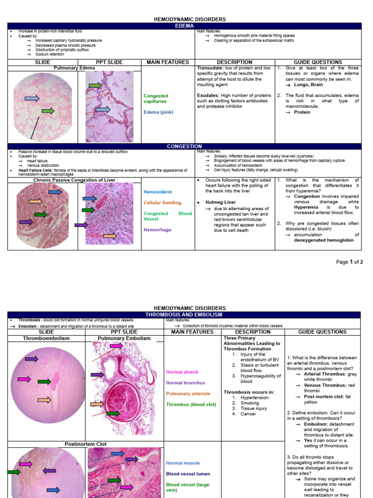 EDEMA | PDF | Thrombosis | Edema