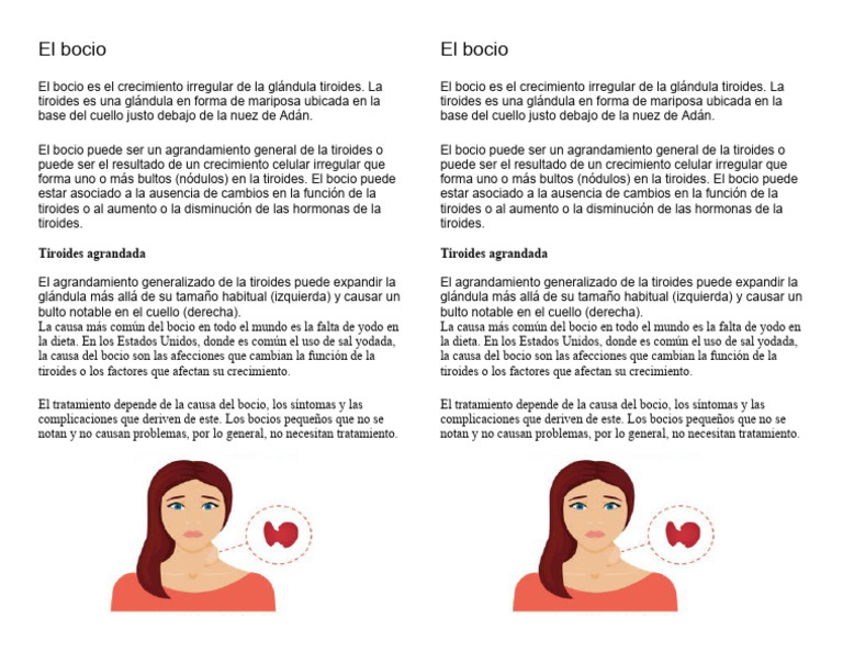 El Bocio-Endocrino | PDF | Tiroides | Medicina CLINICA