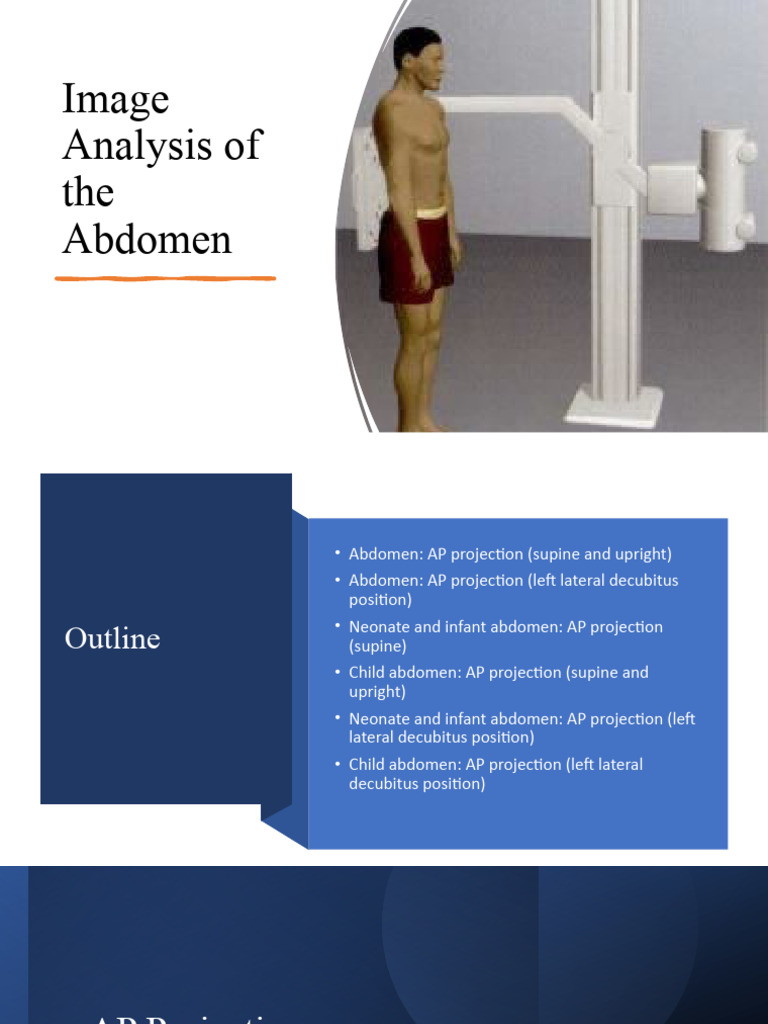 Abdomen Image Analysis | PDF | Abdomen | Vertebra