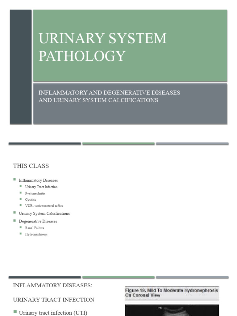 Urinary System Pathologies Inflammatory, Calcifications and ...